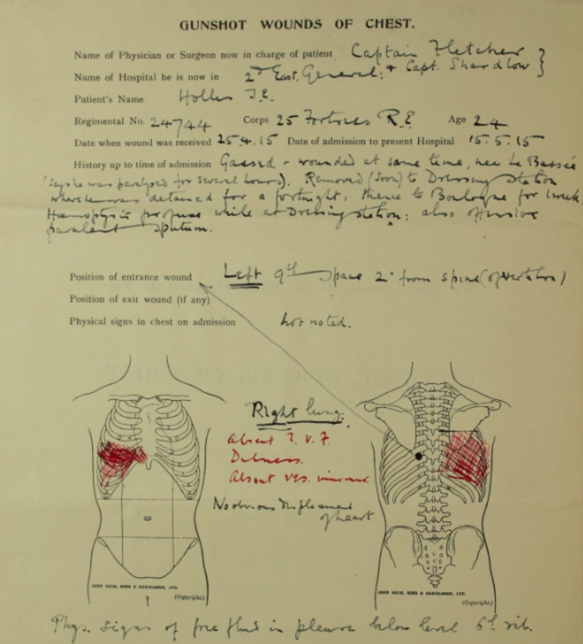 “Medical History of Gunshot Wounds During the First World War” – Center ...