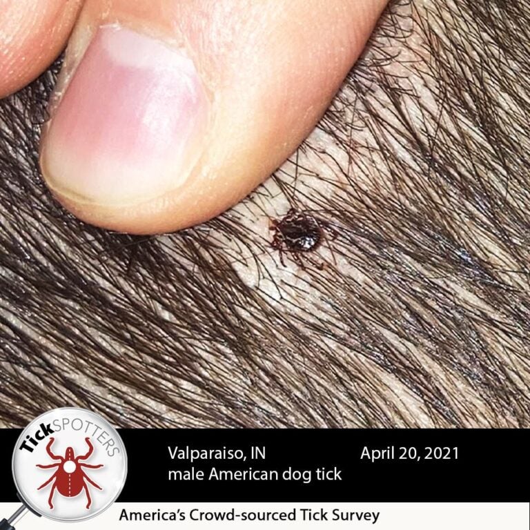 American Dog Tick – TickEncounter
