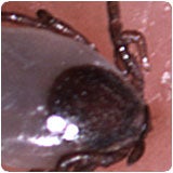 Top Ten Things Everyone Should Know About Ticks These Days – TickEncounter