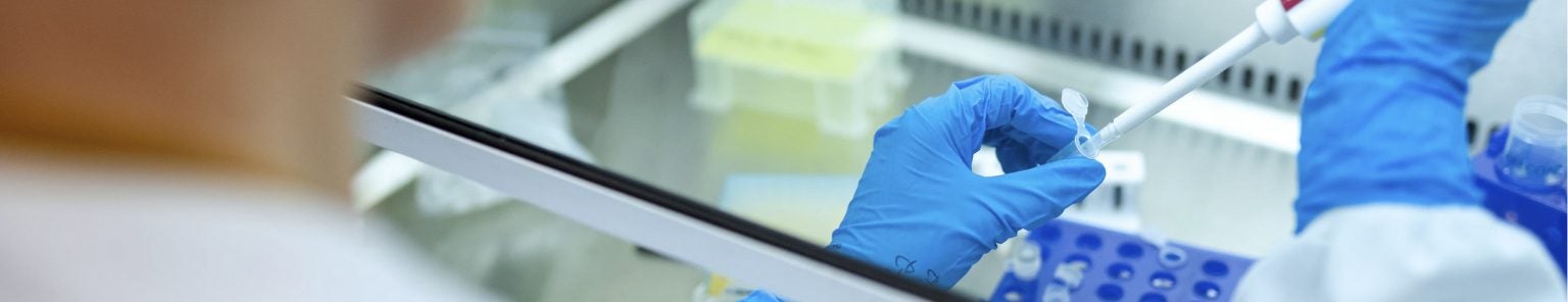 Tick Testing – TickEncounter